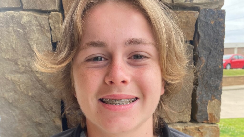 Orthodontist In Tyler, TX - Braces & Invisalign Provider